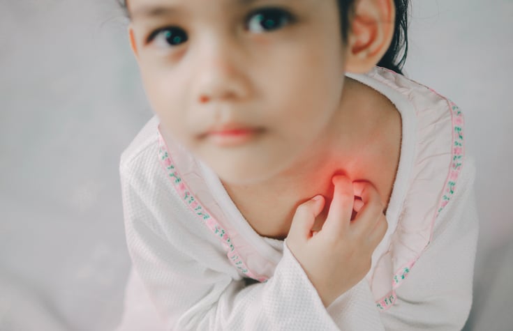 Ringworm: Treatment & Prevention in Children - Indian Crest Pediatrics